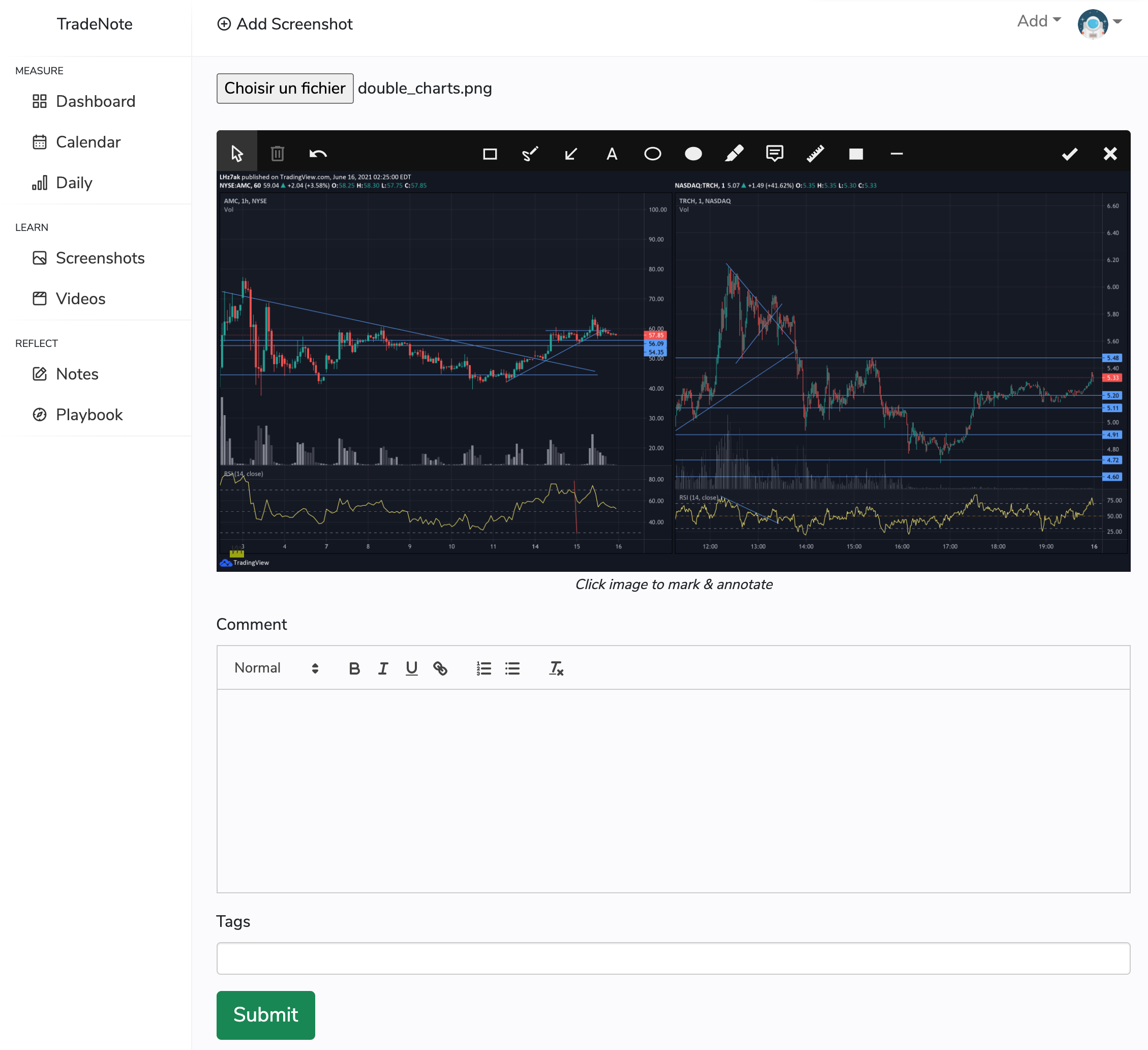 GitHub - Eleven-Trading/TradeNote: TradeNote helps traders store, discover and recollect trade ...